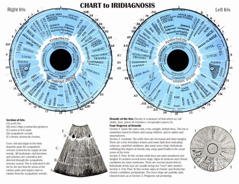 What Is An Iridology Chart? – Maikong Iridology Pictures And Meanings